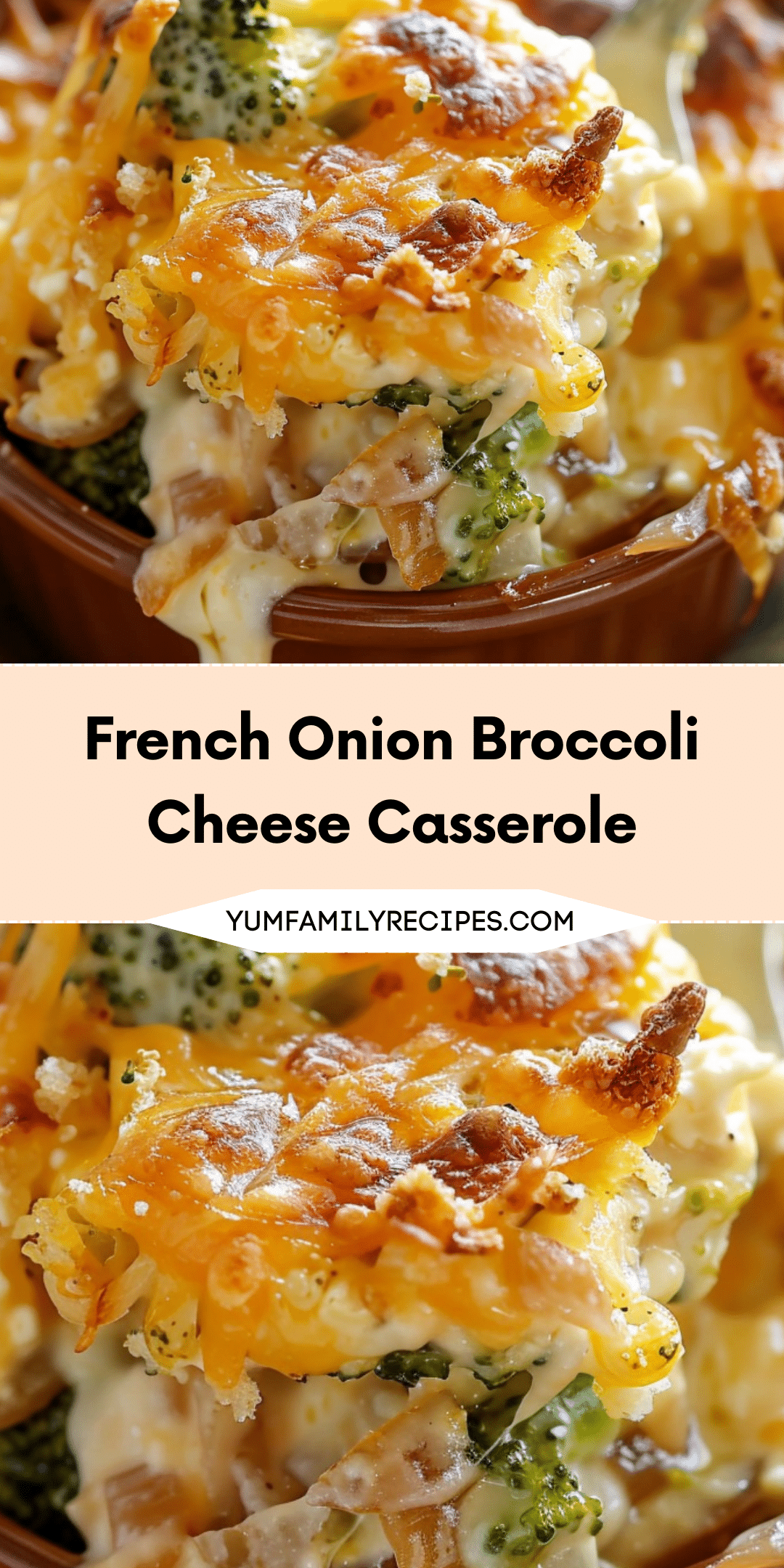 French Onion Broccoli Cheese Casserole | Yum Family Recipes